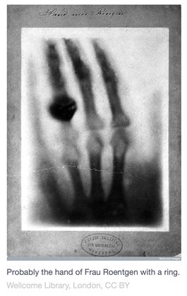 The Discovery of X-Ray