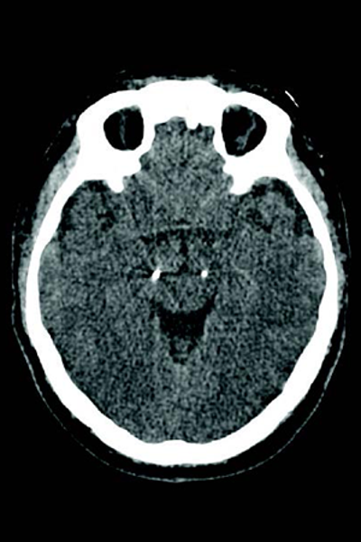 BodyTom® | Portable Full Body CT | NeuroLogica - Samsung