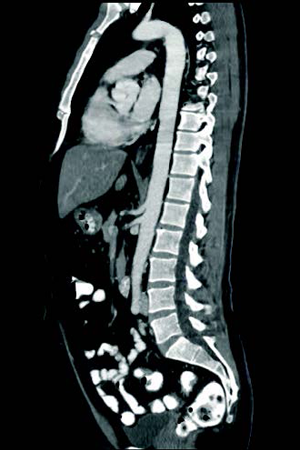 BodyTom® | Portable Full Body CT | NeuroLogica - Samsung